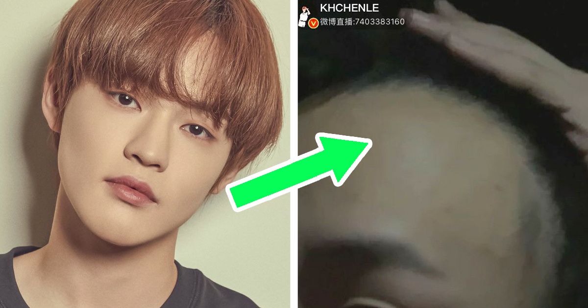 NCT's Chenle Raises Concerns After Showing His Hair Loss - Koreaboo