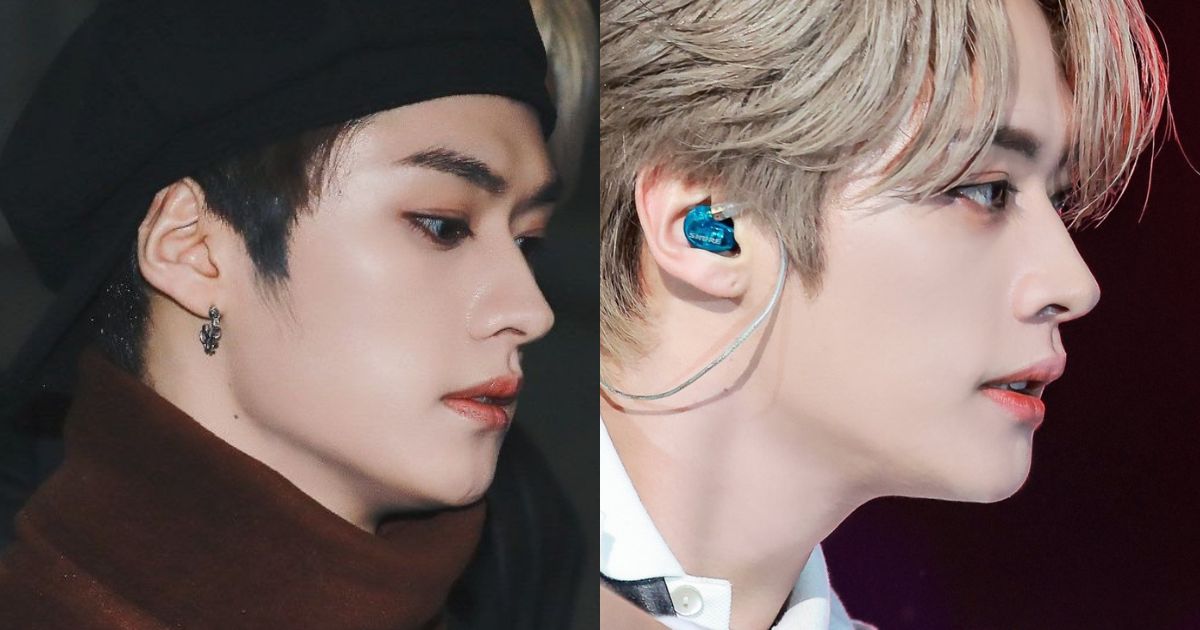 Stray Kids' Lee Know Unknowingly Shut Down Any Room For Nose Job ...