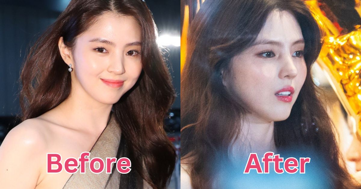 Actress Han So Hee Continues To Clarify Nose Job Rumors - Koreaboo