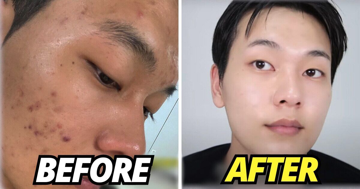 Korean YouTuber Transforms His Skin With 8 Easy Tips - Koreaboo