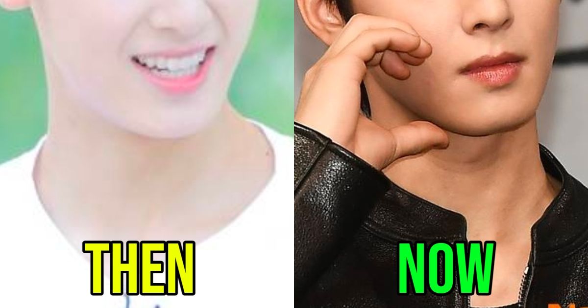 Netizens Can't Get Over ASTRO Cha Eunwoo's Visual Development Between Debut And Now - Koreaboo