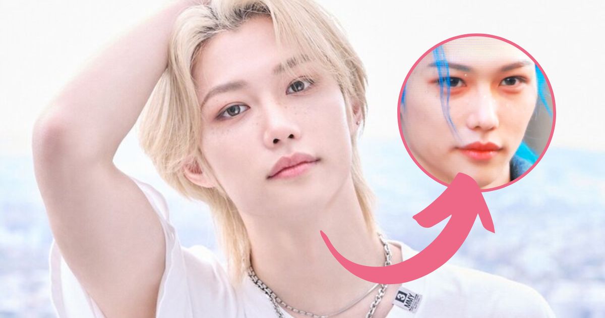 Stray Kids' Felix Shocks Fans With A Stunning And Vibrant New Hair ...