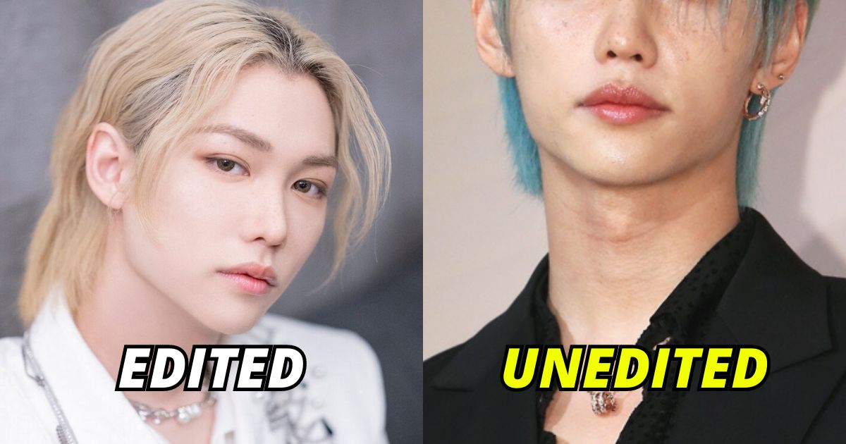 "The Freckles Are Out" — Stray Kids' Felix Shines In Unedited Moments ...