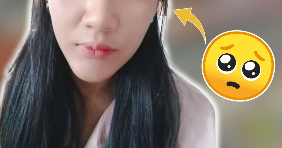 Thai Woman With Four Eyebrows Is Back To Living A Normal Life - Koreaboo