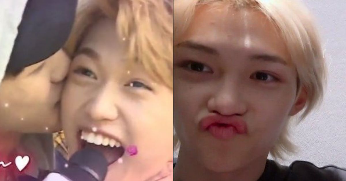 Stray Kids' Felix Does Not Want To Be Kissed - Koreaboo