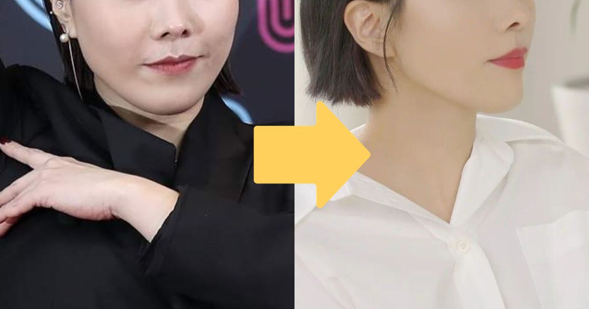 TV Personality Admits To Getting Botox — But It Makes Her Face Look ...