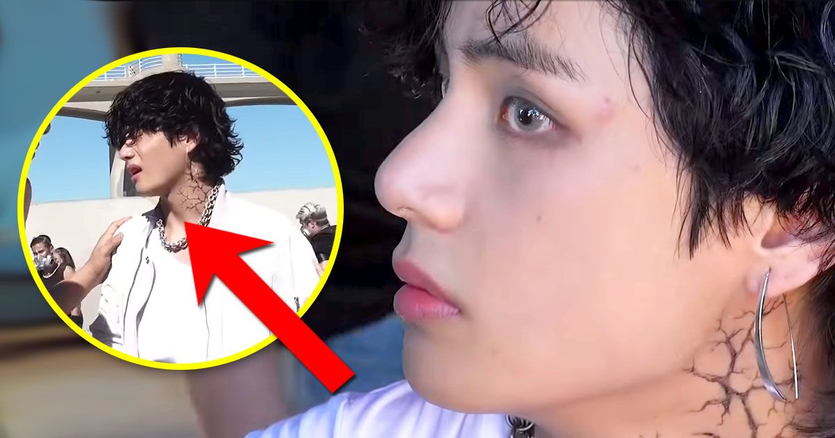 BTS's V Didn't Let An Injury Stop Him From Giving "ON" His All