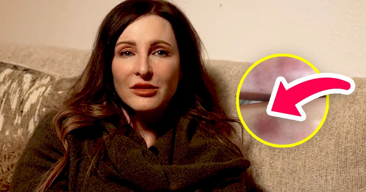 Foreign Actors Expose The Dangerous Injuries They Suffered On Korean ...