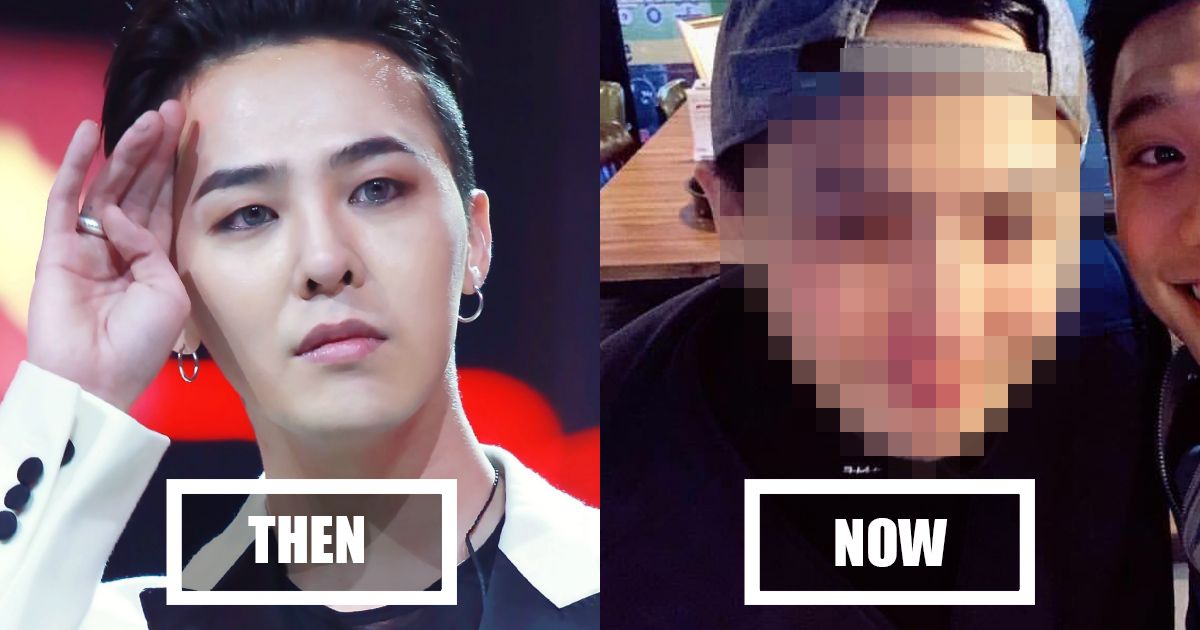 G-Dragon's Recent Photos Show Healthy Weight Gain Since Enlistment