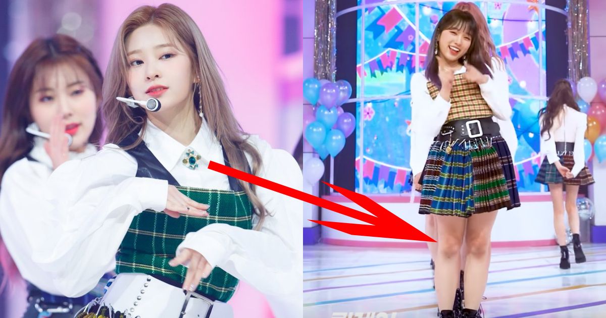 IZ*ONE Members Spotted With Bruised Knees On Each Of Their Legs, Fans ...