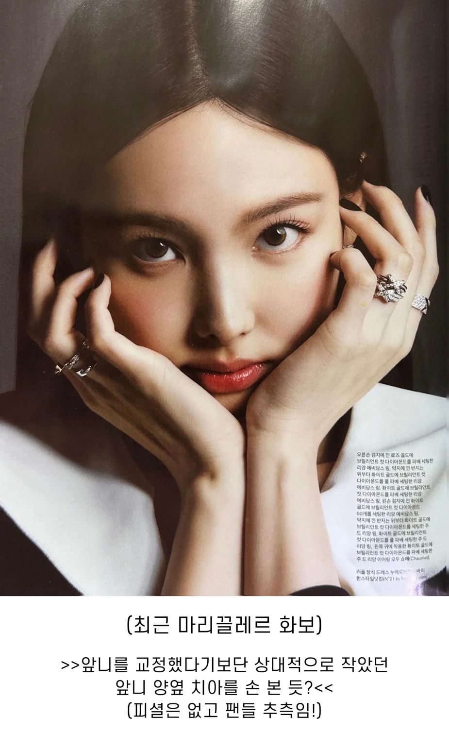 TWICE's Nayeon Gets Rid Of Her Iconic Bunny Teeth And Reveals Her New ...