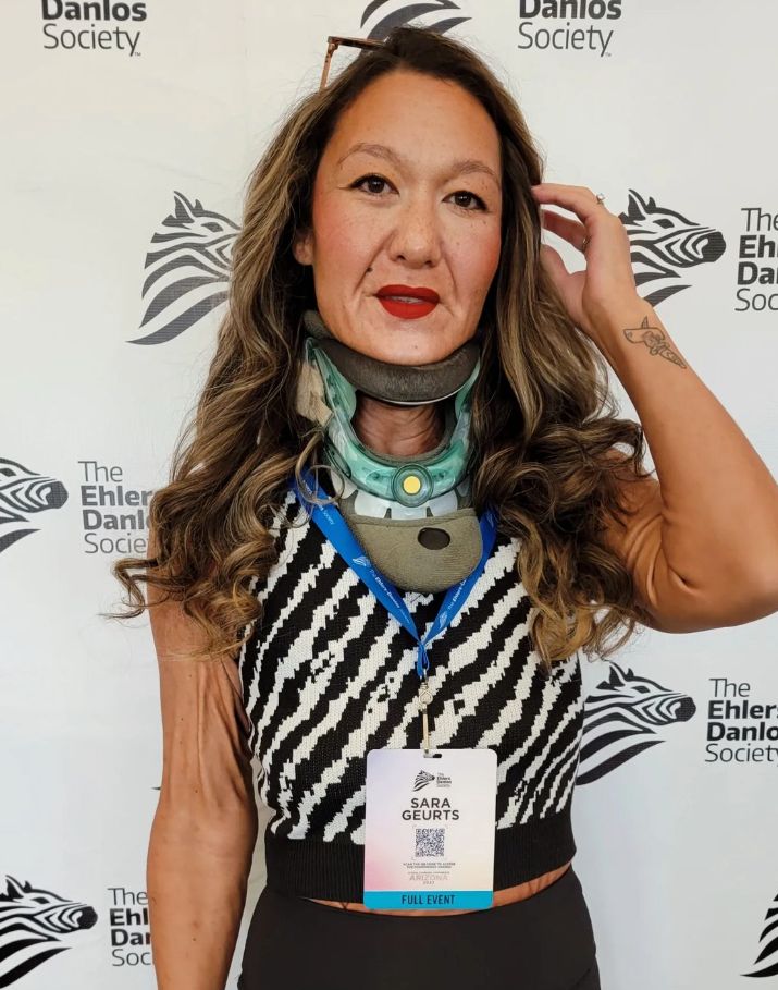 Where Is She Now? The Young Model Who Went Viral For Her Wrinkles ...