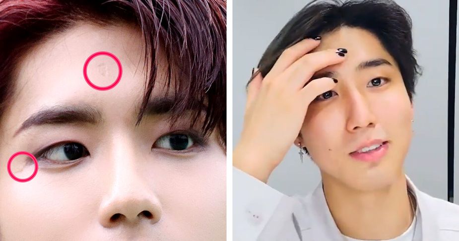 Stray Kids' Han Went To The Hospital Twice For His Scars - Koreaboo