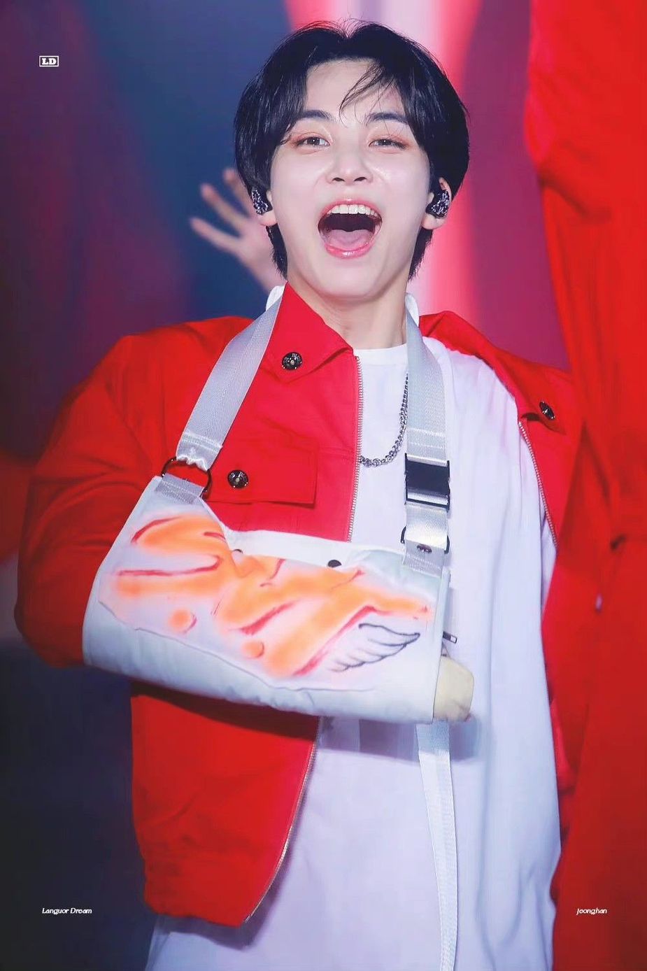 8 Times SEVENTEEN's Jeonghan Stylishly Matched His Arm Cast To His Stage Outfit - Koreaboo